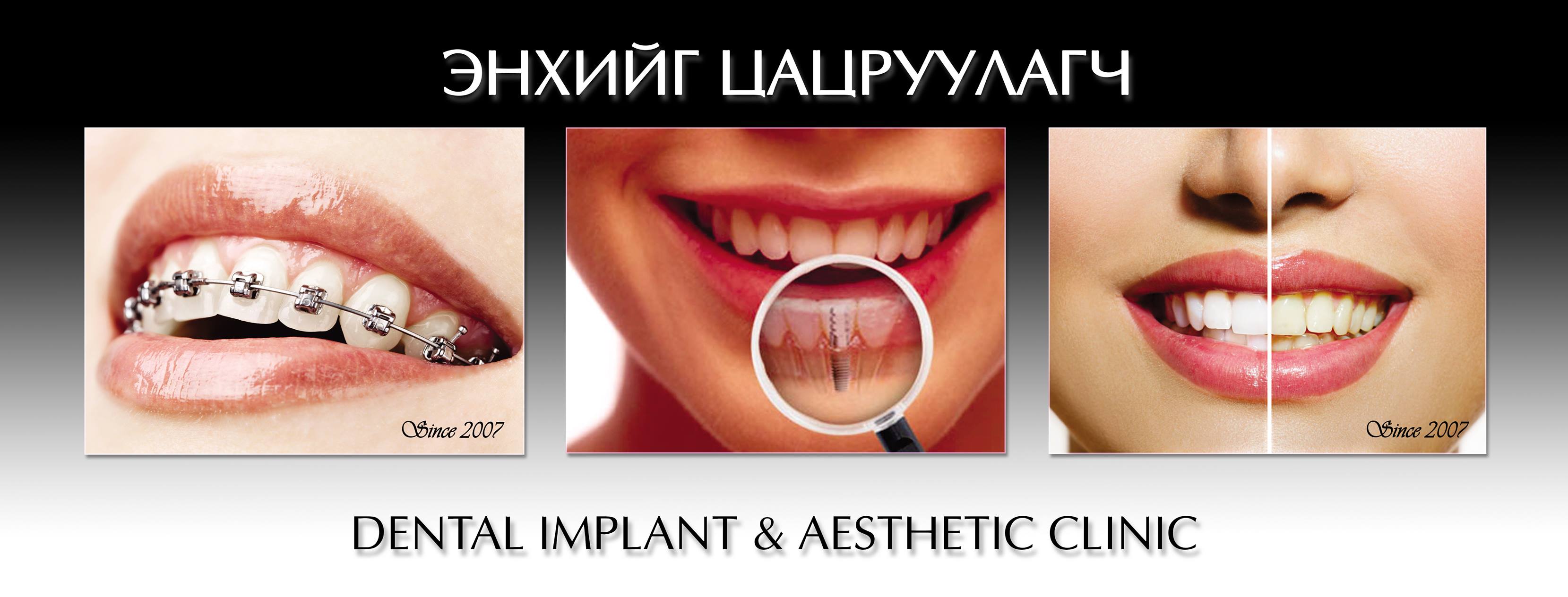 Facebook ХУУДАСНЫ ДЭЛГЭРЭНГҮЙ Энхийг Цацруулагч Шүдний Эмнэлэг